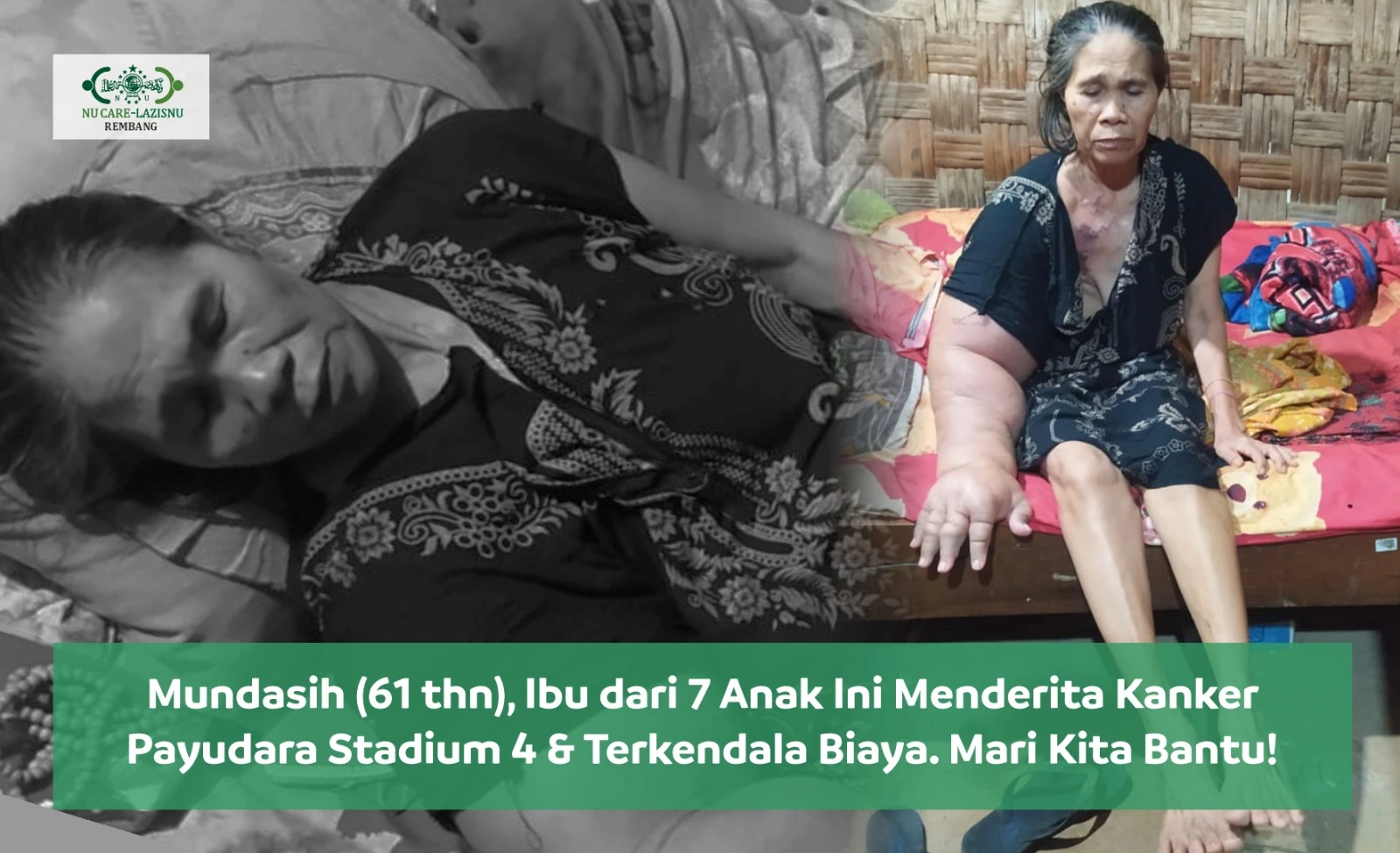 Sofiyah: Bantu Ibu Saya Sembuh dari Kanker Payudara! - NU CARE-LAZISNU